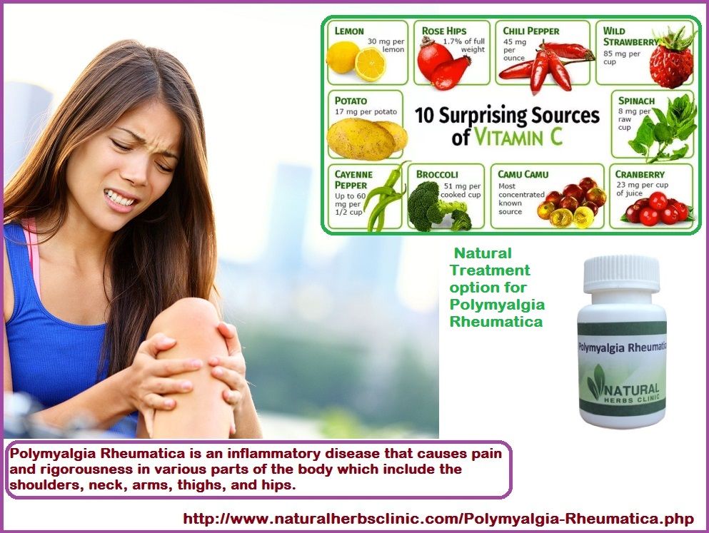 Herbal Remedies for Polymyalgia Rheumatica | Symptoms, Causes ...