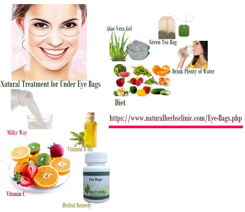Eye Bags Herbal Treatment | Causes, Symptoms - Natural Herbs Clinic