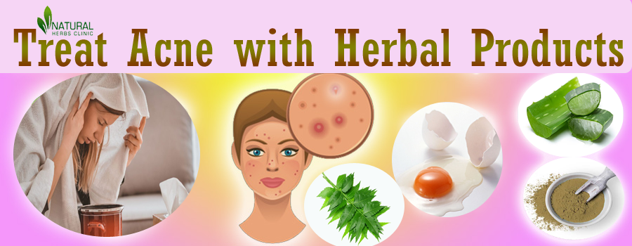 Treat Cystic Acne at Home Effectively with Herbal Products for Acne