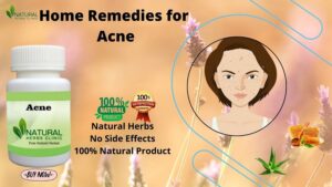 Proven Natural Remedies for Acne Treatment Naturally