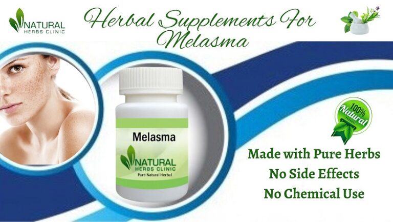 8 Easy Home Herbal Remedies for Melasma - Natural Herbs Clinic Blog