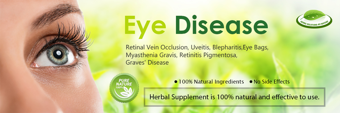 Herbal Supplement for Eye Health: Tips for Maintaining Good Eyesight ...