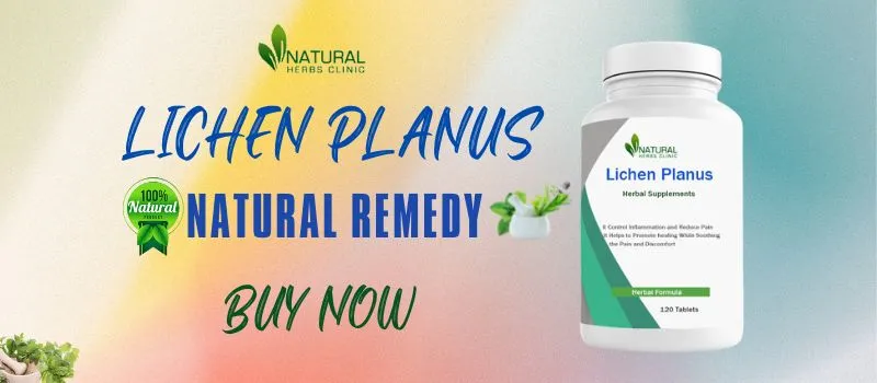Use Herbal Treatments for Lichen Planus to Stop from Spreading