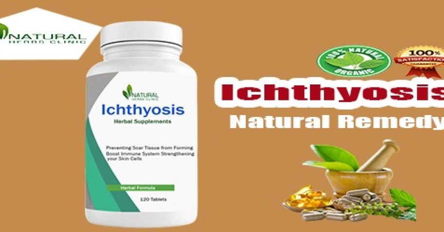 Ichthyosis Vulgaris Natural Treatment Archives - Natural Herbs Clinic ...