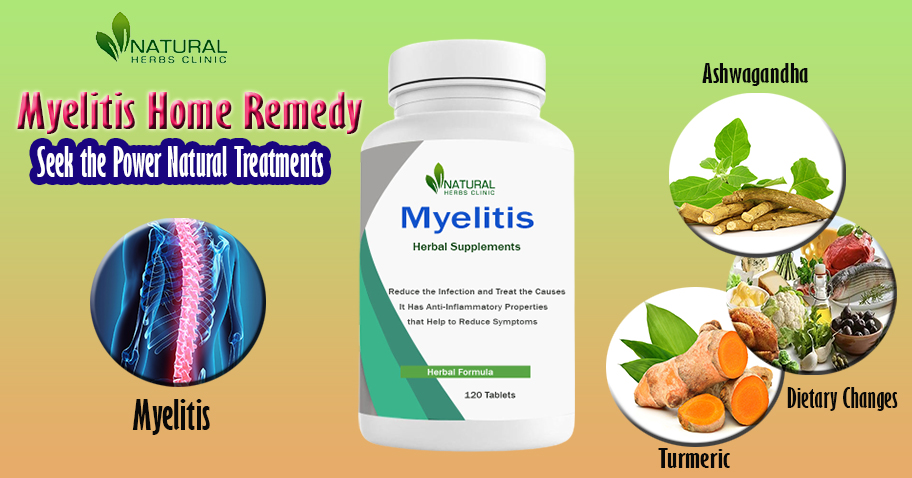 Home Remedies for Myelitis: Seek the Power Natural Treatments