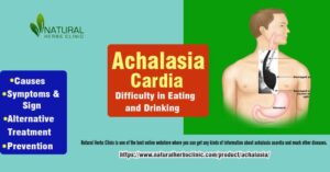 Achalasia Cardia Definition: The Enigmatic Esophageal Disorder
