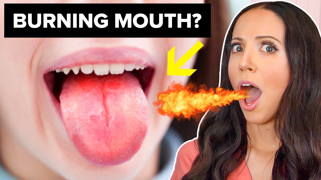 Burning Mouth Syndrome Sufferers Swear By These 7 Supplements - Natural ...