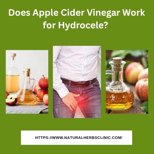 Does Apple Cider Vinegar Work for Hydrocele? Truth Behind the Natural Remedy - Natural Herbs ...